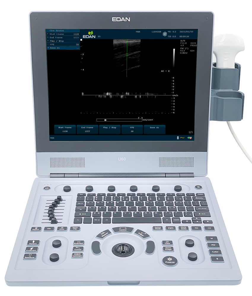 Ultrasound Systems
