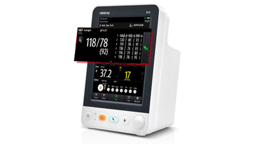 Mindray VS 8: High-Speed, Accurate Vital Signs Monitor | Hospital ...